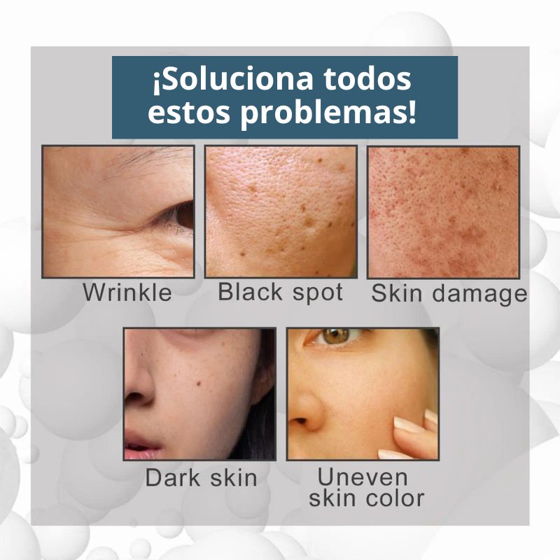 EELHOE BOOST® Potente Serum Anti Envejecimiento – Kast.pe